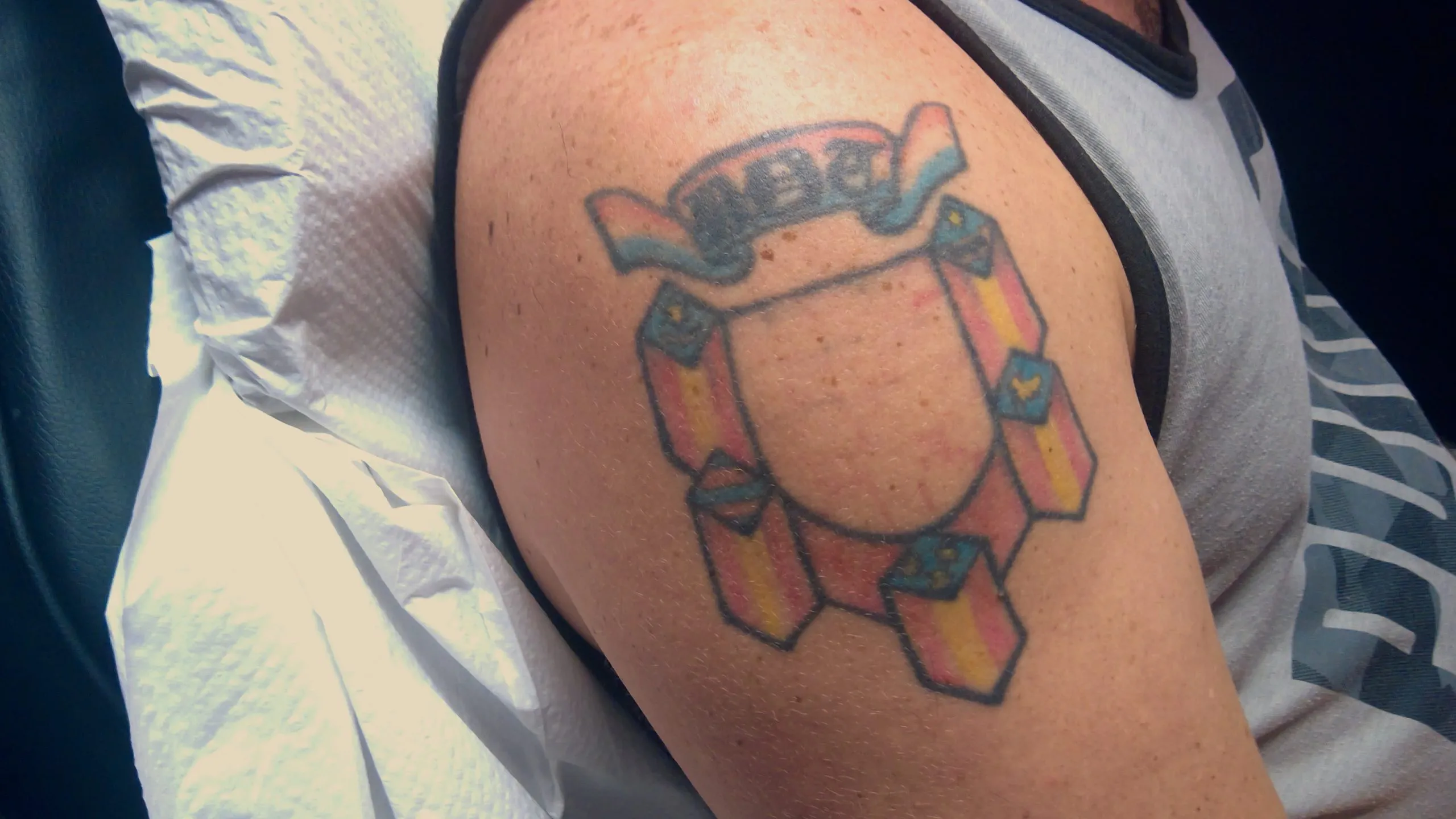 Before and After: Crest Tattoo Removal | Legacy Tattoo Removal